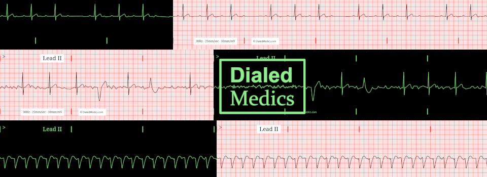 Free EKG Library - Software Generated EKG's
