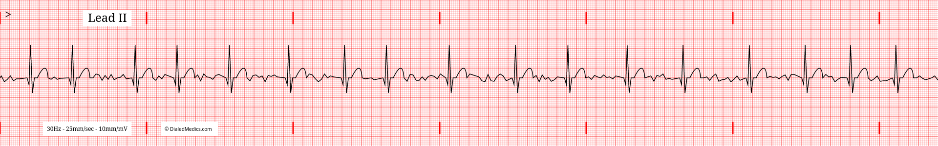 A Software EKG Generator