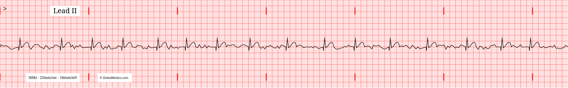 A Software EKG Generator