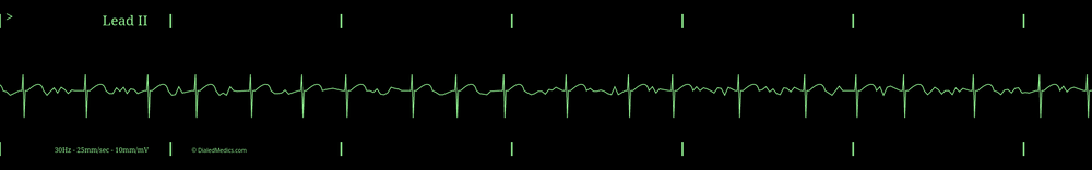 A Software EKG Generator