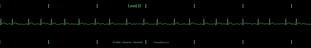 A Software EKG Generator