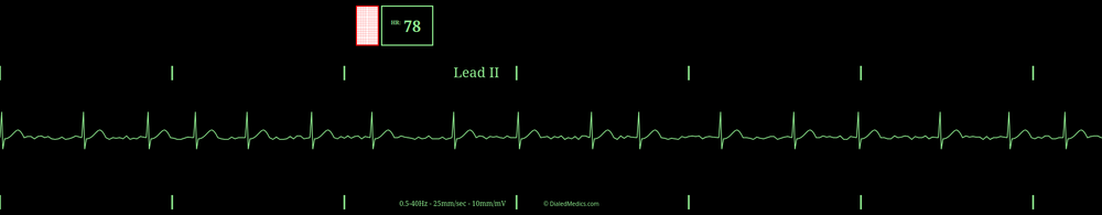 A Software EKG Generator