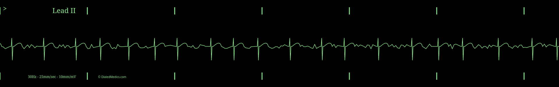 A Software EKG Generator