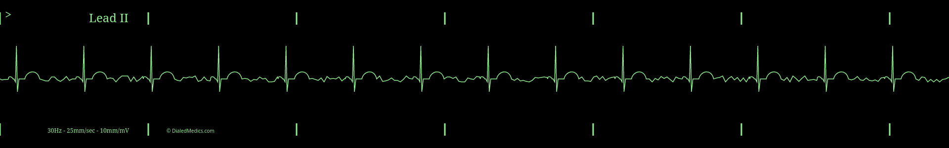 A Software EKG Generator