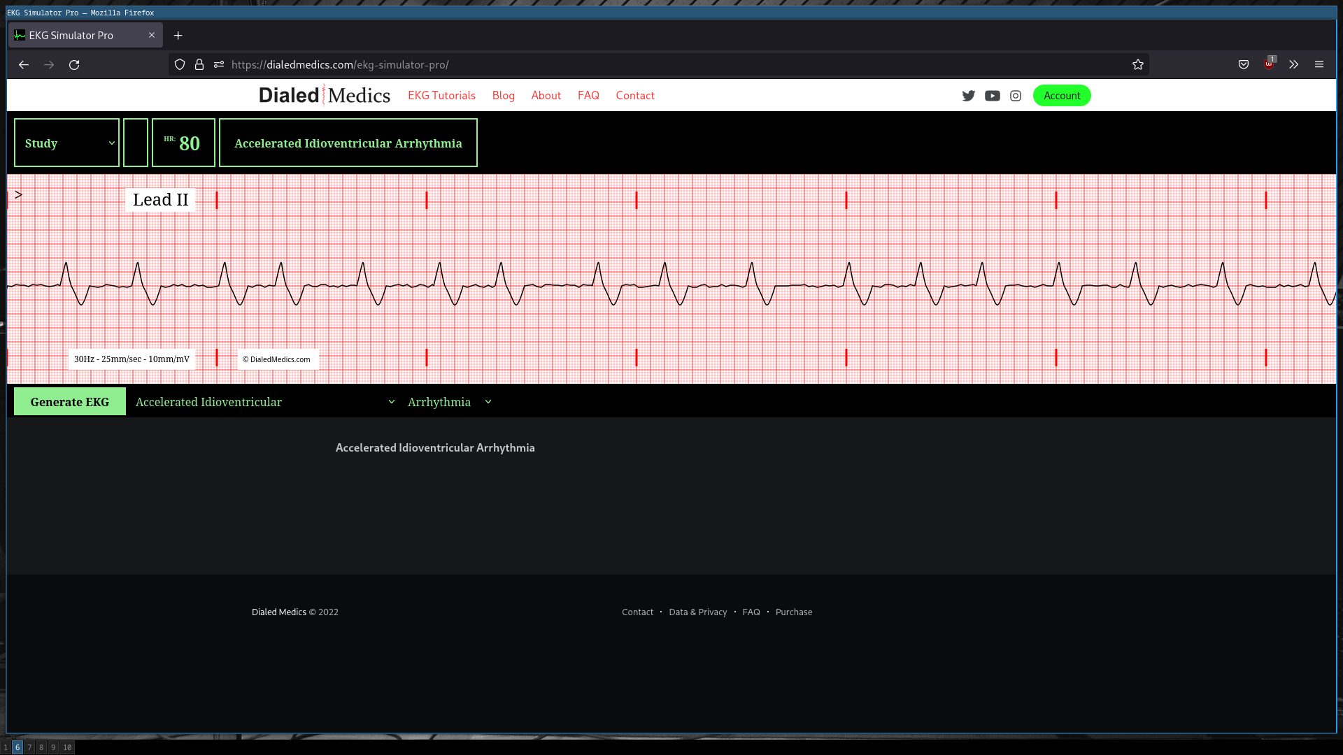 A Software EKG Generator