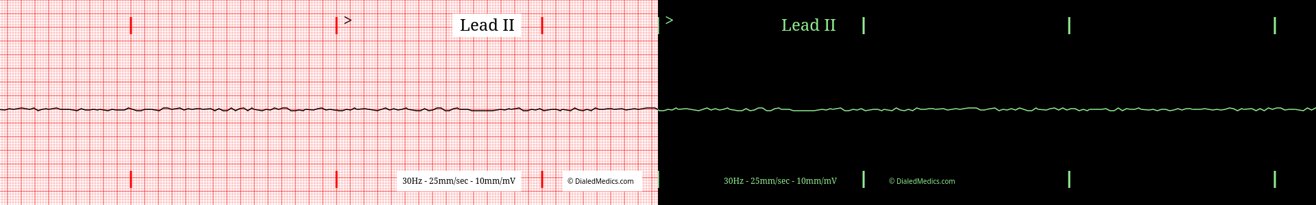 A Software EKG Generator