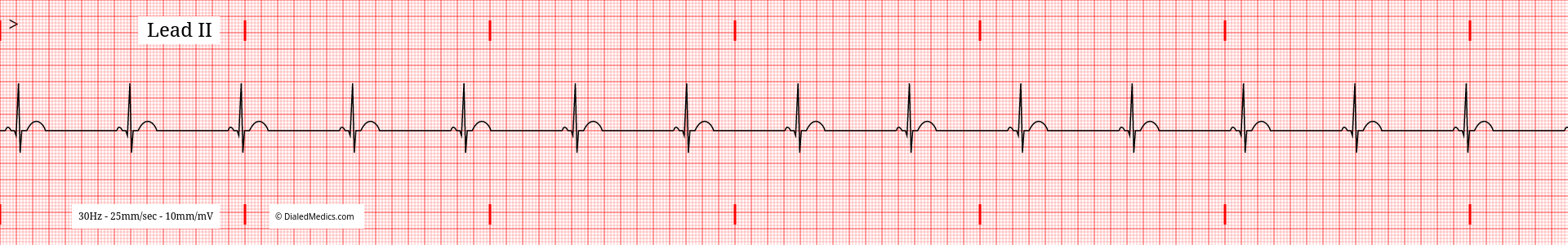 A Software EKG Generator