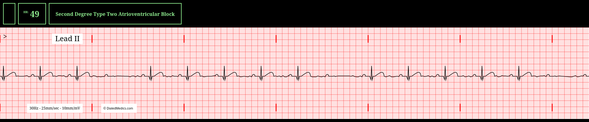 A Software EKG Generator