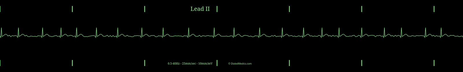 A Software EKG Generator