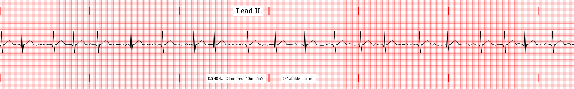 A Software EKG Generator