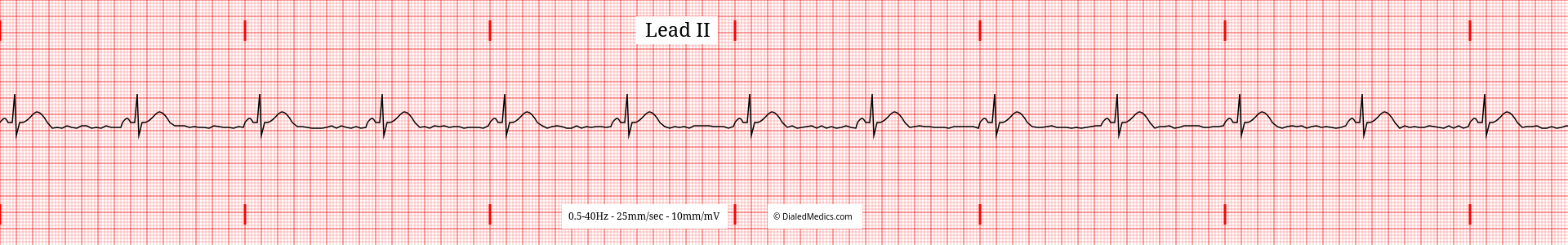A Software EKG Generator