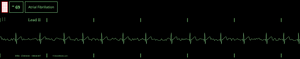 A Software EKG Generator