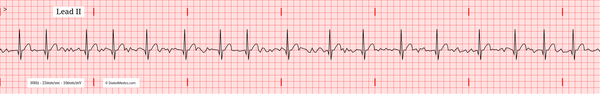 A Software EKG Generator