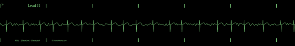 A Software EKG Generator