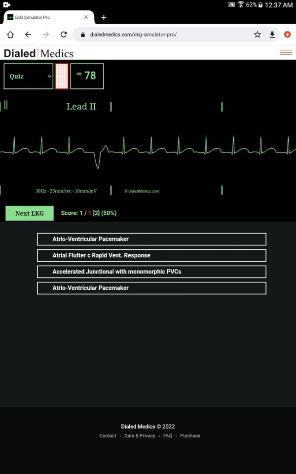 A Software EKG Generator