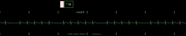 A Software EKG Generator