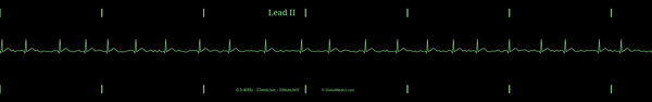 A Software EKG Generator