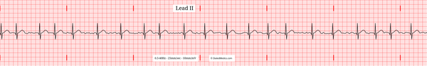A Software EKG Generator
